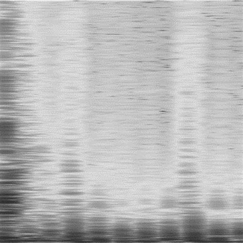 Example Of Respiratory Sound Spectrogram Download Scientific Diagram