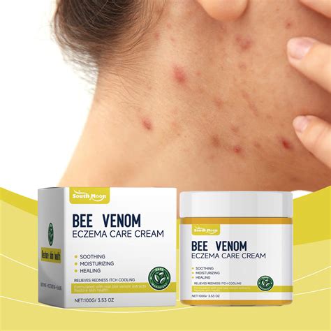 Bee Venom Eczema Care Cream Gentle Formula Relieves Itchy Skin And