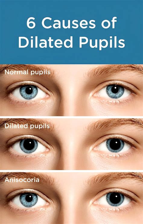 Pupil Size Charts Template Spark Premium Template Template Spark