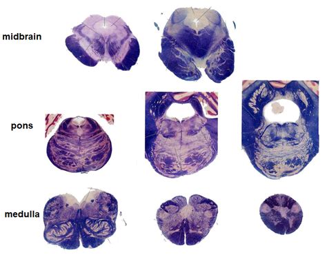 Midbrain Nuclei Internal Anatomy Of Brainstem Diagram Quizlet