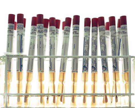 Why You Need A Pap Smear And What Do Your Results Mean