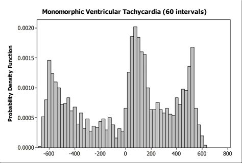 Histogram Based On Sec Segment Length Signal From MIT BIH Database Download Scientific Diagram