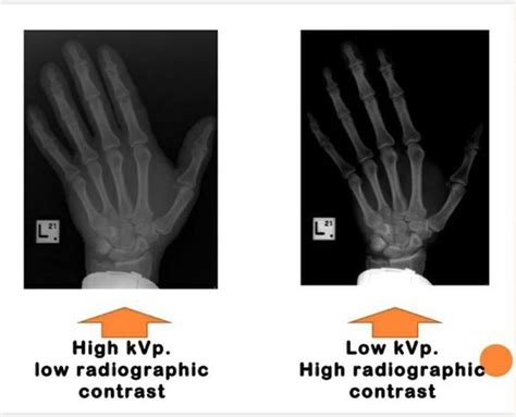 1000 Images About Radiology On Pinterest Ankle Fracture Radiation Exposure And Anatomy