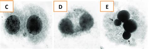 Chromosomal Aberrations And Nuclear Anomalies Download Scientific