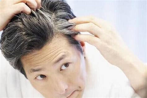 年纪轻轻白发越来越多我还能黑回去吗