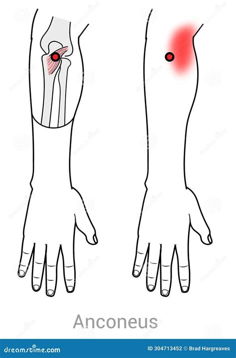 Anconeus Stock Illustration Illustration Of Acupuncture 304713452