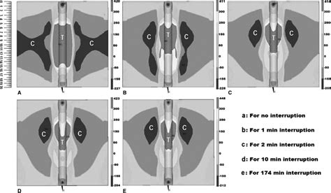 Longitudinal Residual Stress Contours For Various Interruption