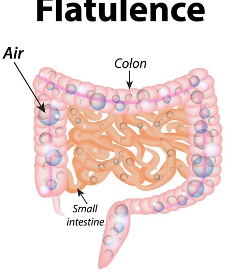 Flatulence Nurture Ayurveda