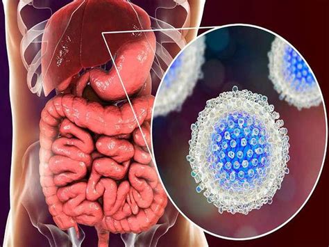 Uruguay Alerts On Prevalence Of Hepatitis C Virus Prensa Latina