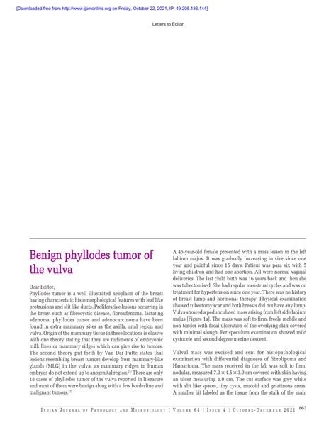 Pdf Benign Phyllodes Tumor Of The Vulva