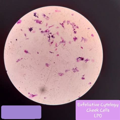 Sports Drink Used To Collect The Cheek Cells Instead Of Water At Brent Vangundy Blog