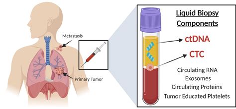 Liquid Biopsy Sample Handling Bitesize Bio