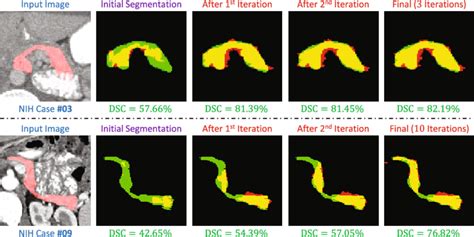 Examples Of Segmentation Results Throughout The Iteration Process Best