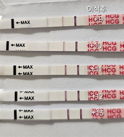 난임일기 시험관 2차 3일배양 신선이식 증상 1차 피검사 임신 확인 이식 후 임테기 2차피검사 네이버 블로그