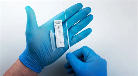 Rast Test Price Range And Preparations Medisuggest