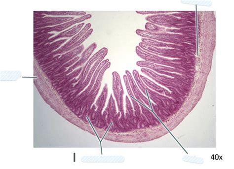 Lab 8 Jejunum Ilium Histology Flashcards Quizlet