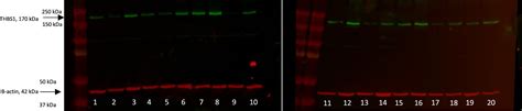 Transcriptomics And Proteomics Revealed Sex Differences In Human Pulmonary Microvascular
