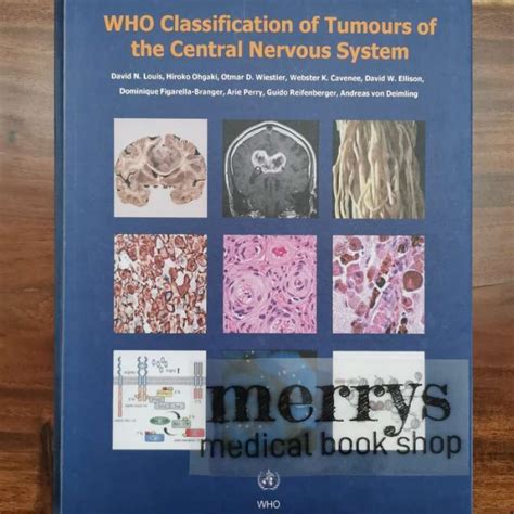 Promo Buku Kedokteran Who Classification Of Tumours Of Central Nervous