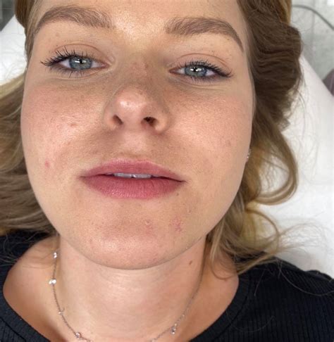 Lill Med Adrianna Lill Med Adrianna Szwajkowska