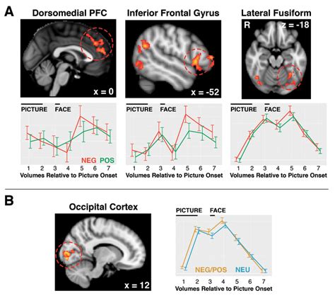 A Whole Brain Voxelwise Analysis For The Valence Contrast Revealed
