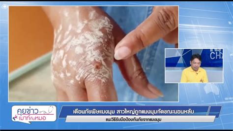 พบหมอรามาฯ Page 69 Of 386 รามา แชนแนล ขับเคลื่อนสังคมไทยให้สุขภาพดี