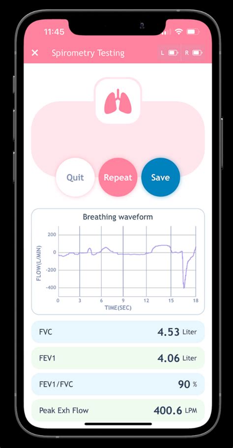 Spirometry Testing For Asthma Monitoring Via Aimwell Ayo Bt