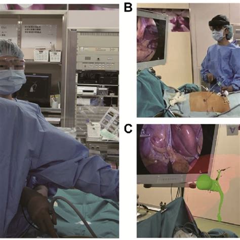 Surgical View Of Laparoscopic Cholecystectomy With 2 Dimensional 2d Download Scientific