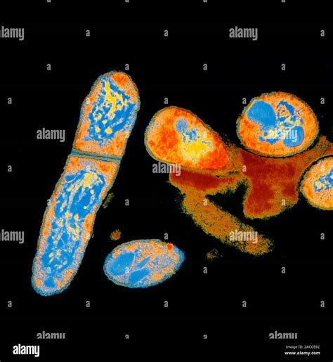 Mycobacterium Tuberculosis Coloured Transmission Electron Micrograph Tem Of The Bacteria