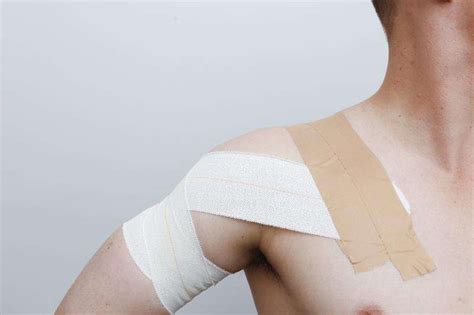 Taping To Protect A Shoulder After A Dislocation Shepparton News