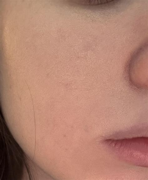 Why Does My Makeup Look So Patchy And Gross R Makeupaddiction