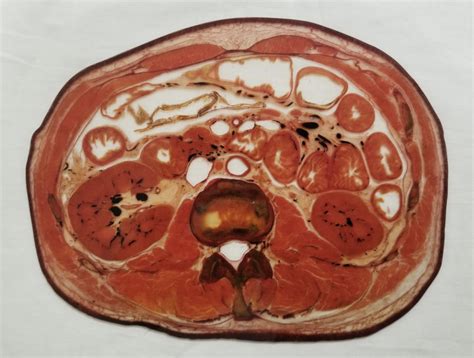 Transverse Cross Section Exam 1 Diagram Quizlet