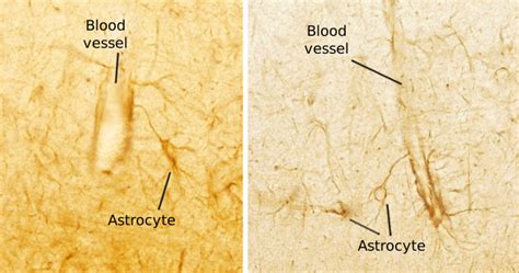 Astrocyte Histology