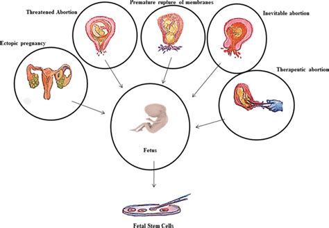 An Alternative Sources Of Fetal Stem Cells With Ethical And Legal