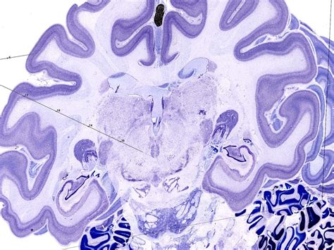 Brainmapsorg Brain Atlas Brain Maps Brain Structure