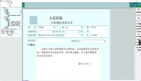 带三维重建和还原的pacs源码 医院pacs系统源码 Pacs系统源码