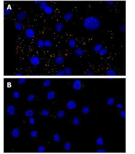 Duolink® Pla Multicolor Detection Protocol