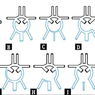 Morphological Spectrum Involving The Anterior And Posterior Circle Of