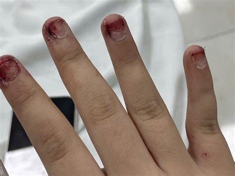 Hà Nội Tạm Giữ 3 đối Tượng Vụ Nữ Sinh Bị đánh Hội đồng Bắt Quỳ Xin Lỗi Báo Tiền Phong