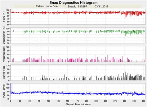 2020 Sleep Histogram Snap Diagnostics Llc