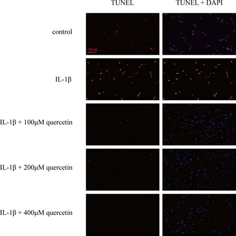 Tunel And Dapi Staining In Five Groups Of Chondrocytes ×200 Download Scientific Diagram