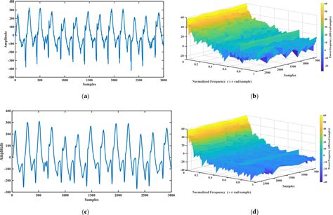 Figure 1 From A New 12 Lead Ecg Signals Fusion Method Using