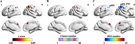 Semi Automated Process Used To Delineate Subject Specific Activation