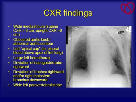 University Of Ottawa Heart Institute Ppt Download