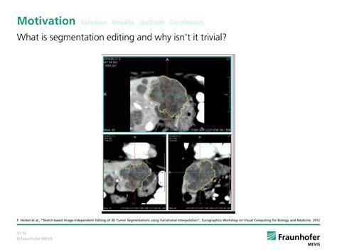Ppt Toward Automated Validation Of Sketch Based 3d Segmentation