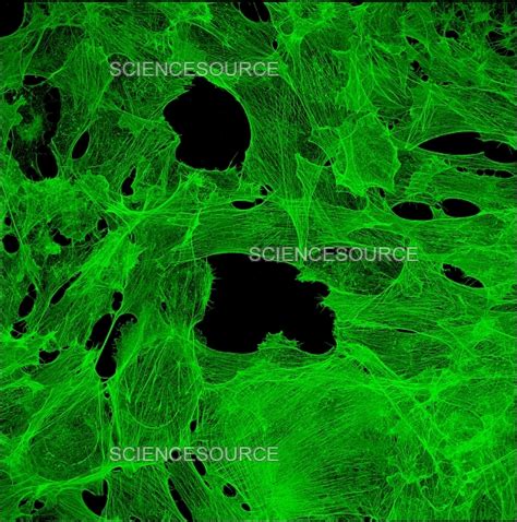 Cancer Cells Showing Cytoskeleton Lig Stock Image Science Source Images
