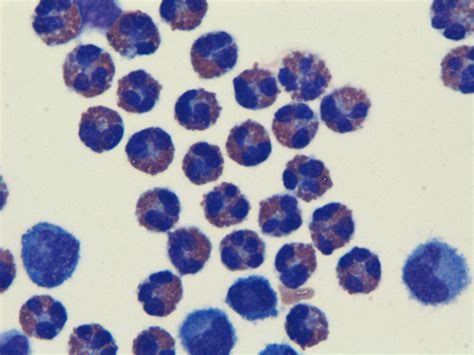 Cerebrospinal Fluid Analysis Vetneurology