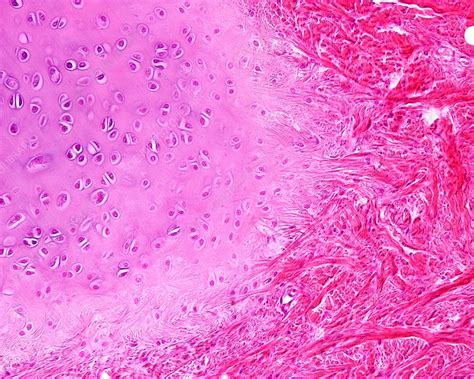 Perichondrium Histology