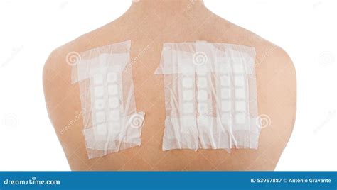 Skin Allergy Patch Test On Bacck Stock Image Image Of Dermatology