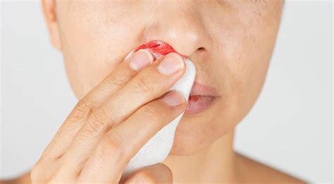 Cure For Nose Bleed Effective Solutions For Quick Relief Crane Philippines
