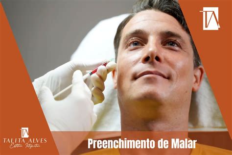 Preenchimento De Malar O Segredo Do Rejuvenescimento Facial
